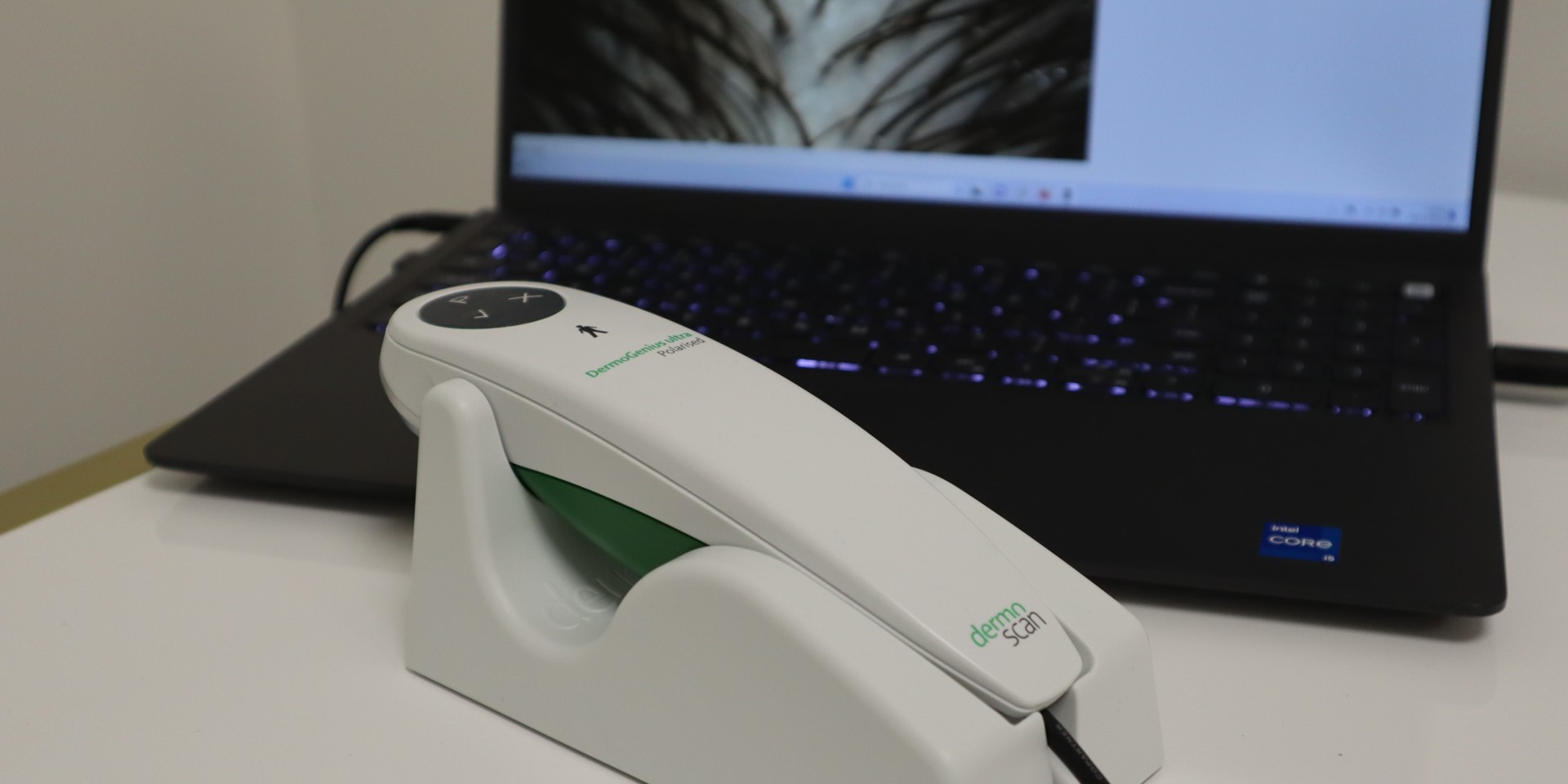 Trichoscan as a professional hair examination tool - GBA Group Cosmetics